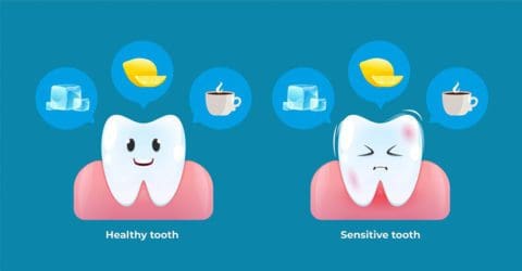 Teeth Hypersensitivity - At-home and In-office Treatment | Parkview ...
